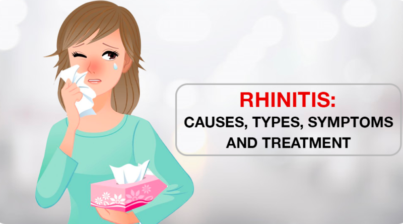RHINITIS: CAUSES, TYPES, SYMPTOMS AND TREATMENT – Nutrition Daily